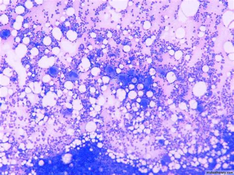 Haematology Bleeding Tendency Pptx غير معروف Muhadharaty