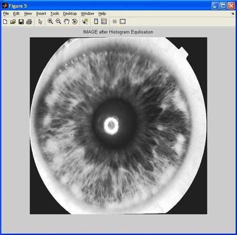 Iris Detection And Recognition Matlab Code Rf Wireless World
