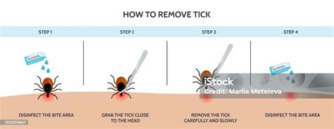 진드기 곤충을 올바르게 제거하는 올바른 방법입니다 질병을 운반하는 미트 기생충 보렐리오시스 뇌염 및 라임 병 진드기에 대한 스톡