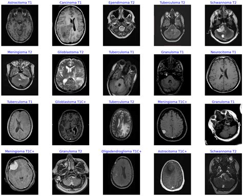 Github Asifikbal1general Image Classifier F1score 95 General Image