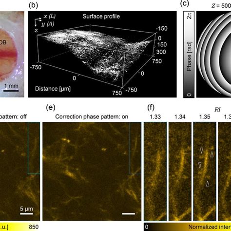 Ao Corrections In Mouses Secondary Motor Cortex A Snapshot Of The