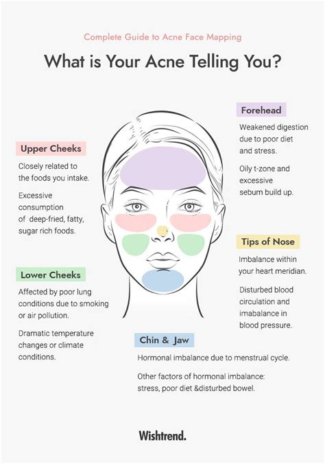 Acne 101 L What Is Acne Telling You Face Mapping Your Acne Face Mapping Acne Face Acne Skin