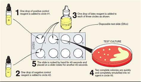 Antigen Antibody Reactions Agglutination And Types Microbeonline