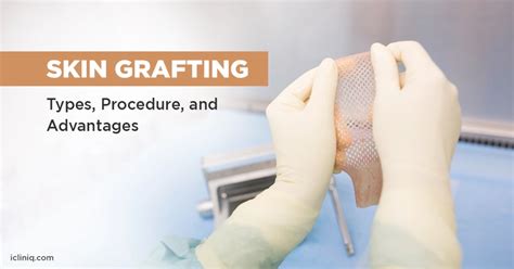 What Is Cadaver Skin Graft Burn Surgery Igzzip