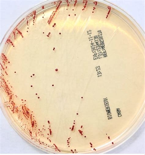 World Of Microbiology Macroconidia Of Histoplasma Capsulatum Isolated From Crohns Disease