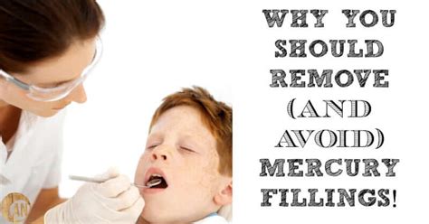Why You Should Remove And Avoid Mercury Fillings Ancestral Nutrition