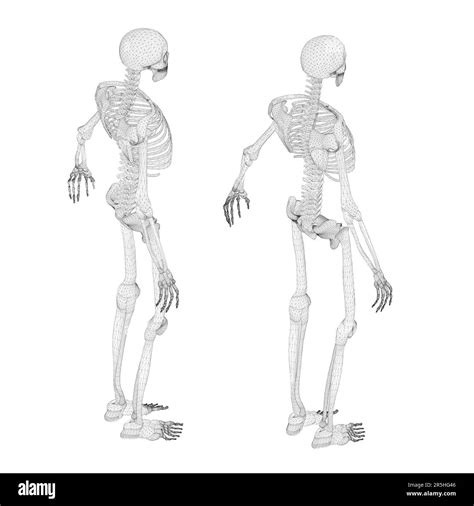 Set With Human Skeleton Wireframe From Black Lines Isolated On White Background Isometric View