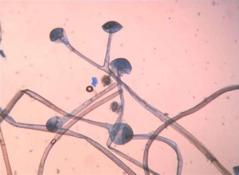 Rhizopus Stolonifer Under Microscope