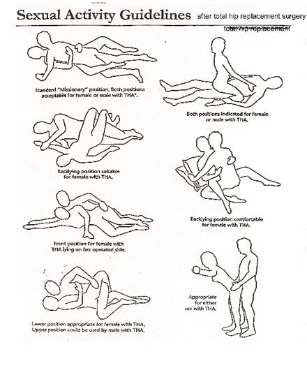 Claudette Lajam M D Sex After Joint Replacement