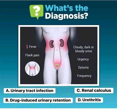 Urinary Tract Infection Uti And Pyelonephritis 🔹 Urinary Tract