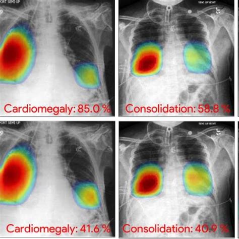 The Saliency Relevance Evaluation Of A Commercially Available Ai Download Scientific Diagram