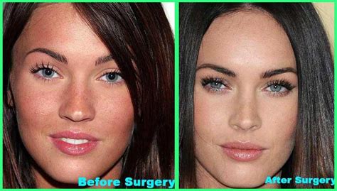 Plastic Surgery Before And After Megan Fox Before And After
