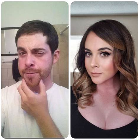 Transgender Surgery Before And After Photos