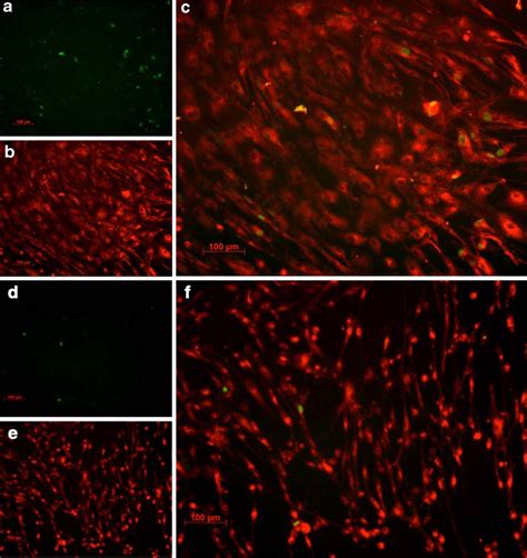 Livedead® Cell Assay Of Human Dermal Fibroblasts A Dead Cells And Ltp