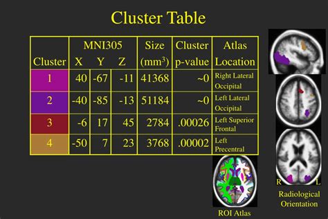 Ppt Basics Of Fmri Inference Powerpoint Presentation Free Download