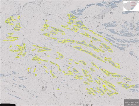 Qupath Script Command To Draw Polygon Annotation From Points Image Analysis Imagesc Forum