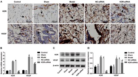 Comparison Of Expressions Of Kinase Insert Domain Containing Receptor
