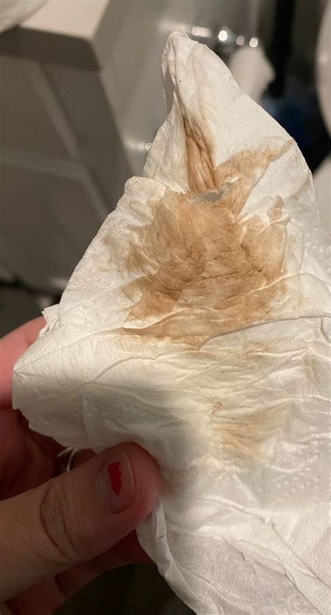 Brown Discharge Implantation Bleeding Brown Discharge Implantation Bleeding