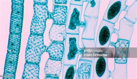 Spirogyra Zygote