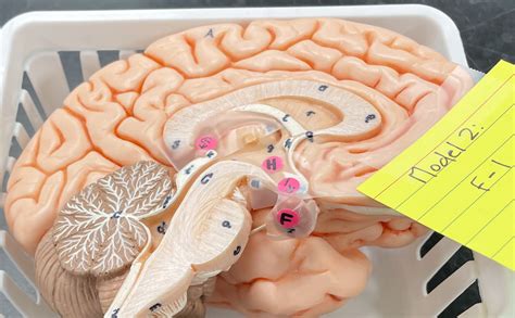Brain Diagram Quizlet