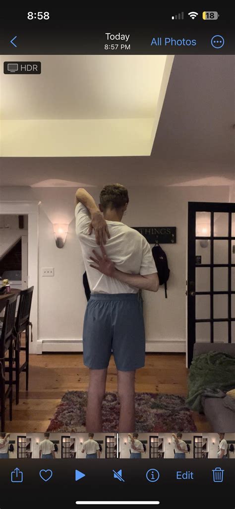 Right Shoulder Immobility R Flexibility