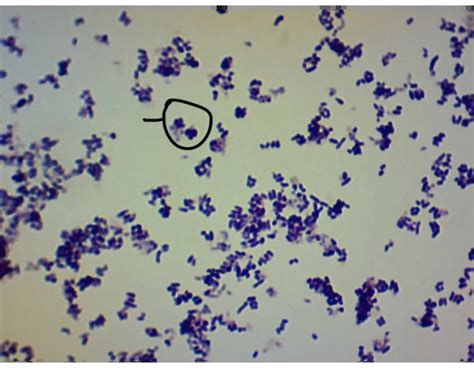 Staphylococcus Gram Stain Quiz