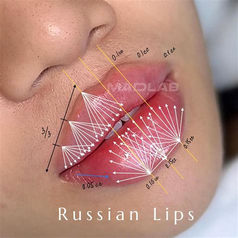 Lip Types Artofit Lip Types Artofit
