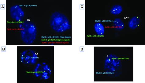 A Nuclei Of Three Blastomeres Using Cytocell Aquarius Kit REF LPA Download Scientific