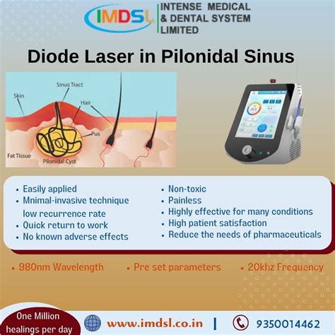 Laser Proctology In Pilonidal Sinus
