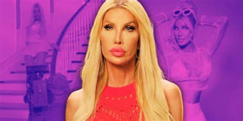 Nikki Plastic Surgery Before And After Pictures Reddit