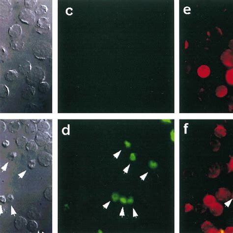 Differential Interference Contrast And Immunofluoresence Microscopy Of Download Scientific