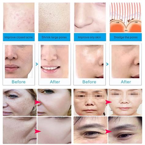 ₩1929695에서 수직 Led 얼굴 광자 치료 Pdt 광선 요법 기계 7 색 피부 노화 방지 미백 피부 회춘 아름다움 기계 Dhgate