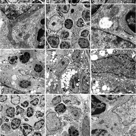 Electron Micrograph Of Thymic Cortex Ad Control Sections A The