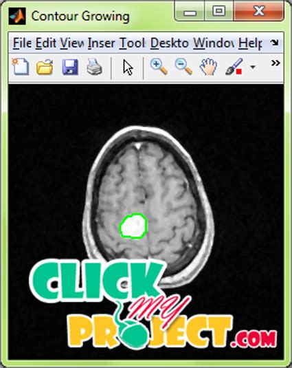 brain tumor segmentation based on a hybrid clustering technique