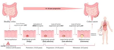What Does CRC Stand For Exploring The Meaning And Importance Of CRC Updated September