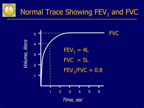 Ppt Spirometry In Primary Care Powerpoint Presentation Free Download