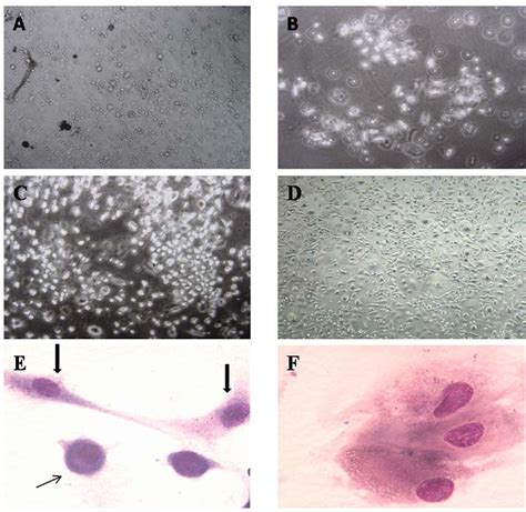 Figure 1 From Reconstruction Of Hematopoietic Inductive Microenvironment After Transplantation