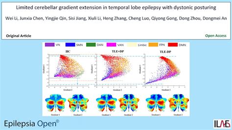 Epilepsia Open Journal On Linkedin Key Point Temporal Lobe Epilepsy