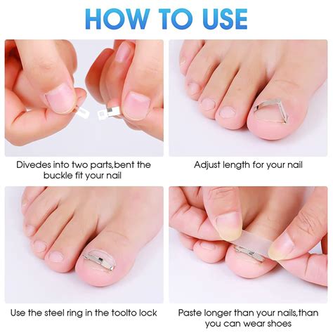 Ingrown Toenail Tools Set 58 Pieces For Correction Treatment And Relief Toe Nail