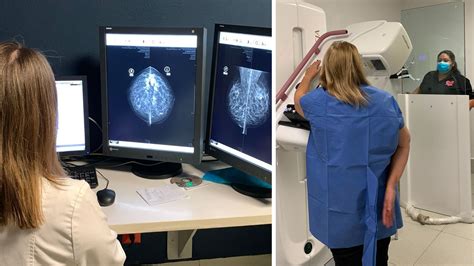 Intensifica Salud Programa De Detección Temprana De Cáncer De Mama
