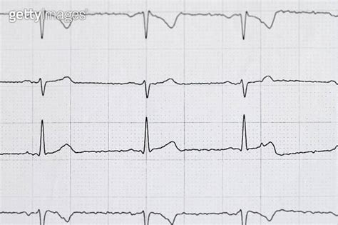 Electrocardiography Ecg Test Heart Rhythm Curve Printout On Paper 이미지 2165530686 게티이미지뱅크