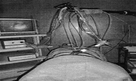 Endoscope Robot Trial On Cadaver Abdomen Download Scientific Diagram