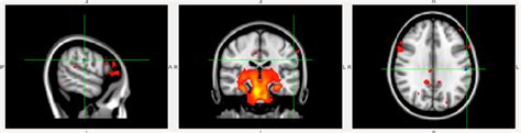 Functional Magnetic Resonance Imaging At Resting State Download Scientific Diagram