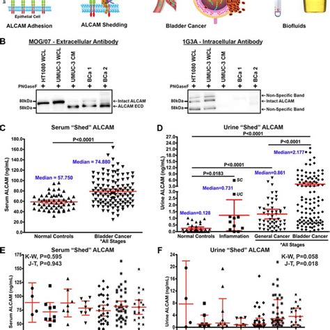 Detection Of Shed Alcam In Biofluids Of Patients With Bladder Cancer