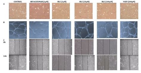 Modulation Of Endothelial Cell Responses To Hlc Bevacizumab And Vegf Download Scientific
