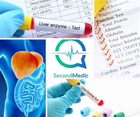 Understanding Liver Function Test SecondMedic