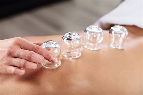 Cupping 101 Everything You Need To Know About This Treatment Aaptiv