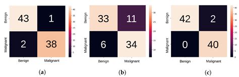 Entropy Free Full Text Benign And Malignant Breast Tumor