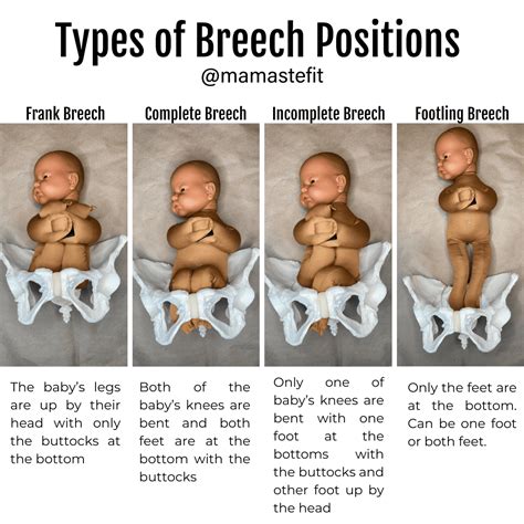 Breech Positions And Birth Options Mamastefit