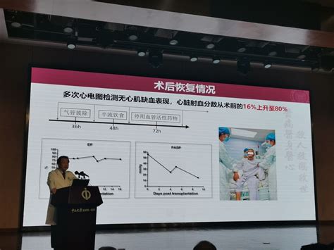 【新华社】中山大学团队成功实施“无缺血”心脏移植 中山大学附属第一医院
